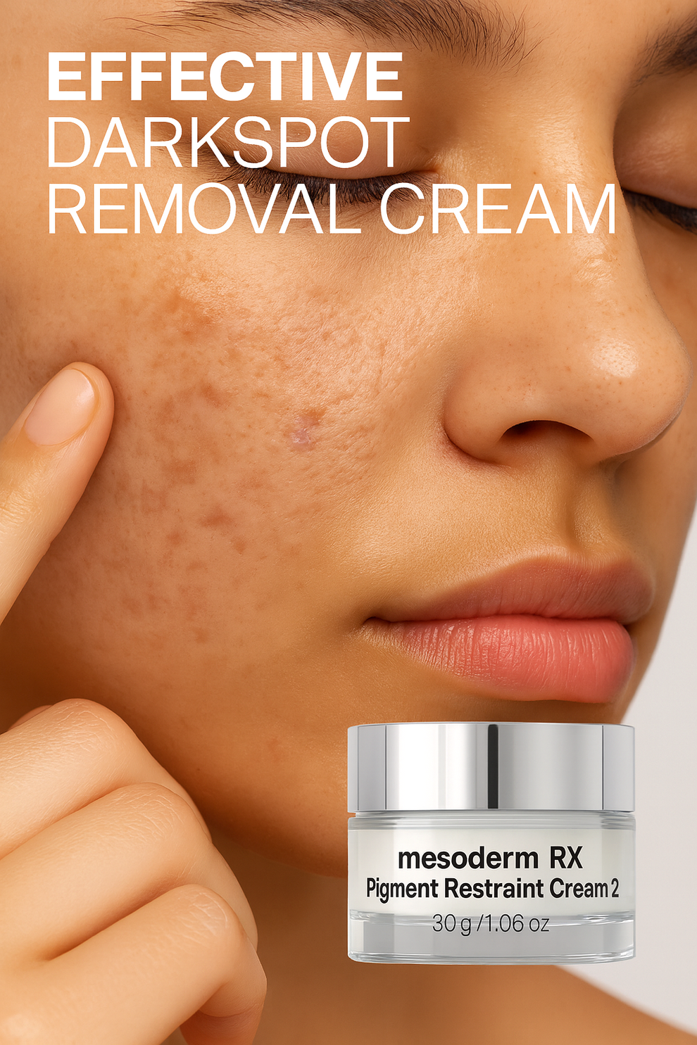Pigment Restraint Cream – Mesoderm RX
